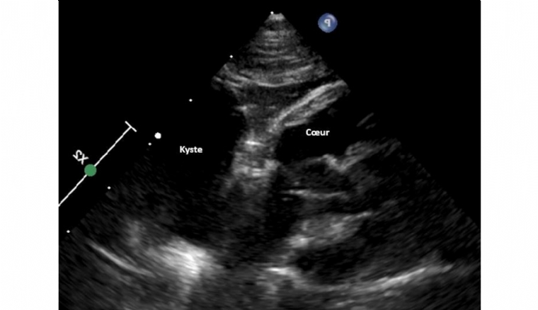 Masse médiastinale découverte fortuitement chez un chat : quel est ...