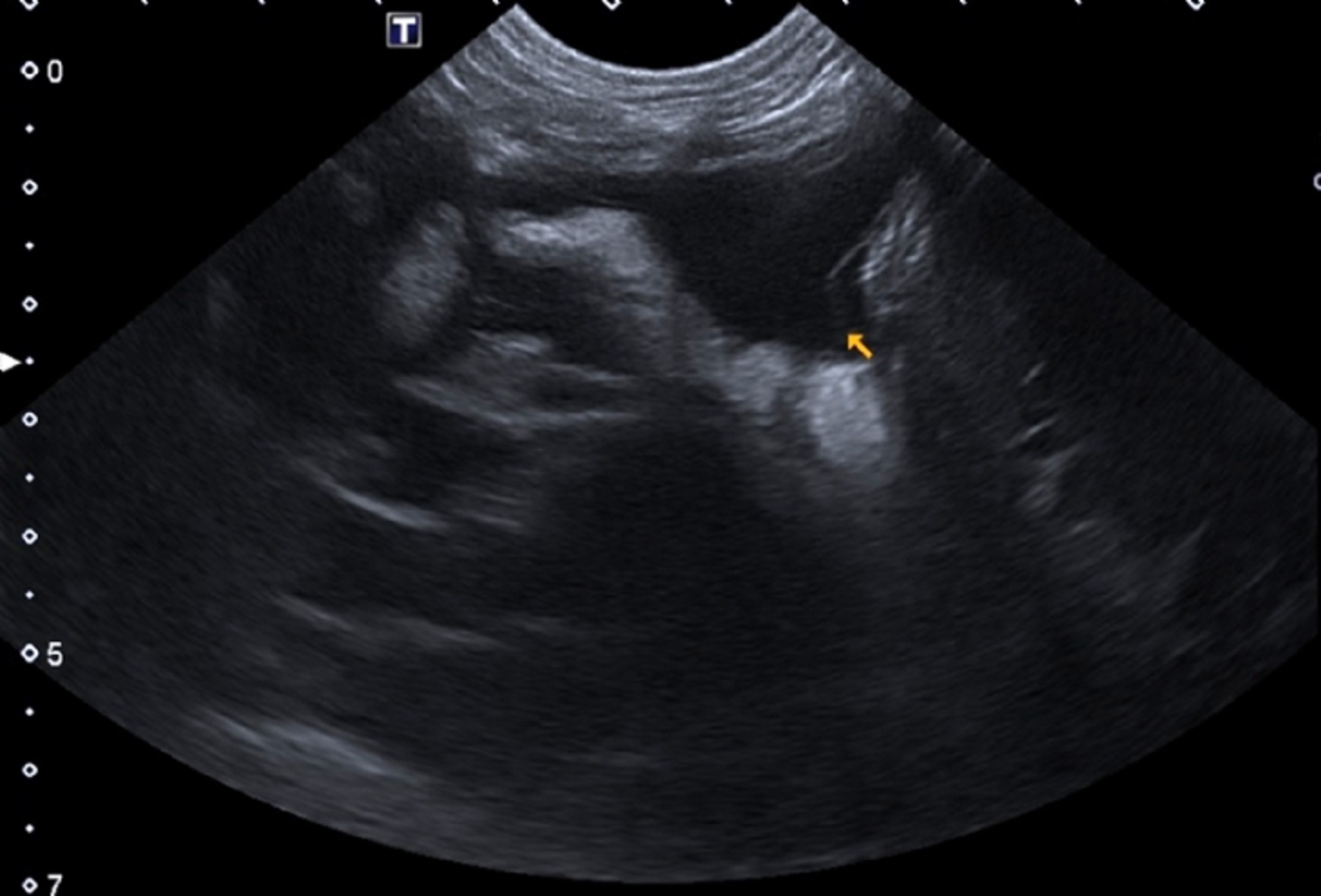Dyspnée et abattement chez un chat européen de six ans : quel est votre ...
