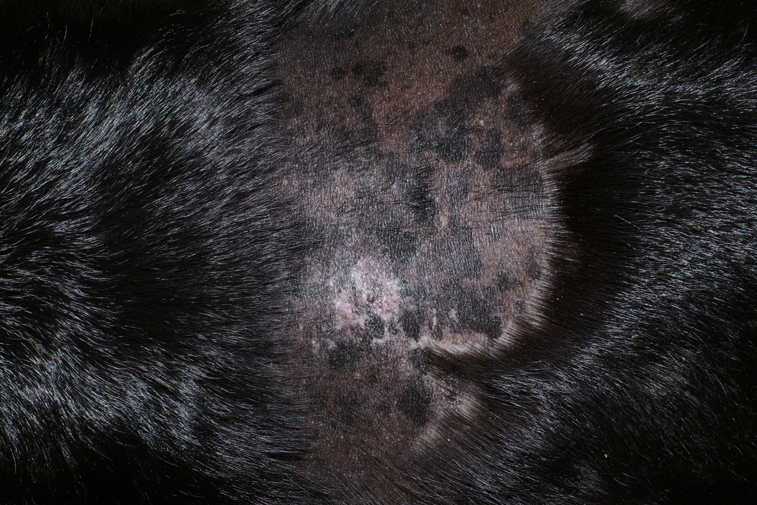 Lésions cutanées douloureuses sur le cou et le thorax : quel est votre ...