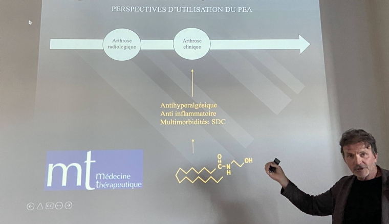 Palmidol PEA : une approche différente du système endocannabinoïde pour ...