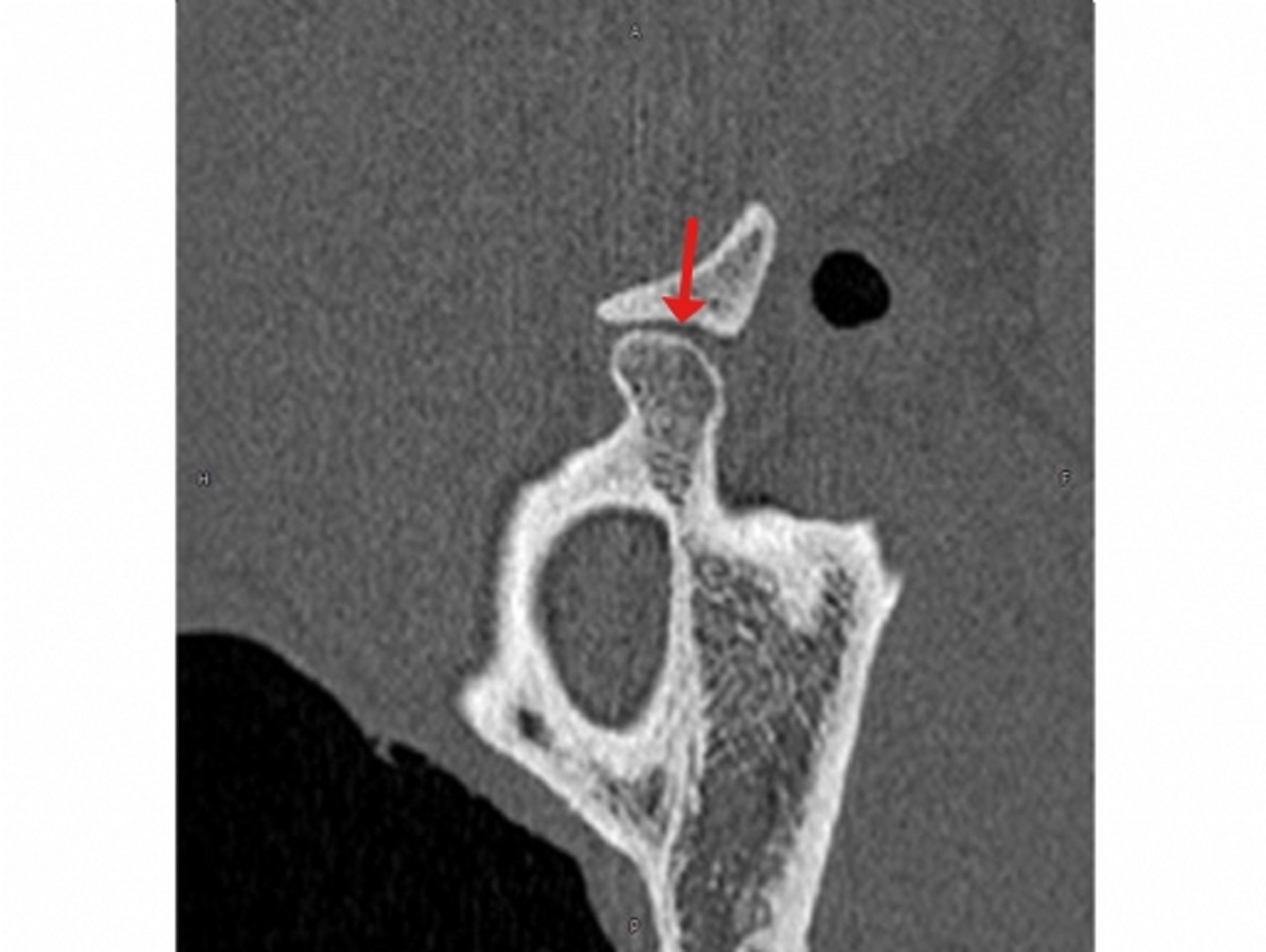 Luxation de la mâchoire chez un boxer : quel est votre diagnostic